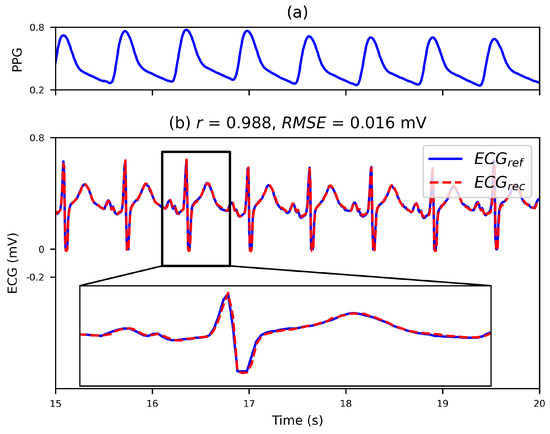 PPG2ECGps: An End-to-End Subject-Specific Deep Neural Network Model for ...