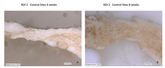 Bioengineering | Free Full-Text | The Use of Human Sterilized Crushed ...