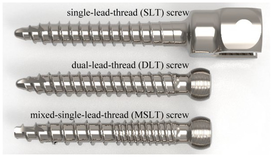Pullout Strength of Pedicle Screws Inserted Using Three Different ...