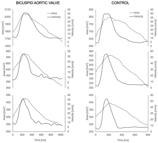 Feasibility of Wave Intensity Analysis from 4D Cardiovascular Magnetic ...
