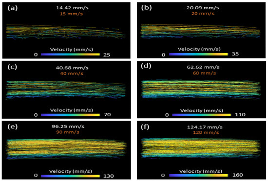 Super-Resolution Ultrasound Localization Microscopy Using High ...