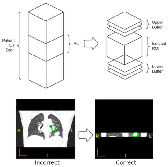 Automated Classification of Lung Cancer Subtypes Using Deep Learning ...