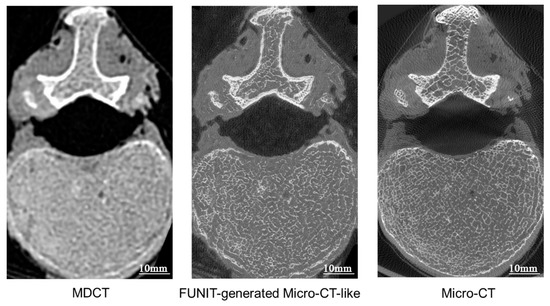 Exploring the Possibility of Measuring Vertebrae Bone Structure Metrics ...