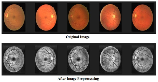 Retinal Vascular Image Segmentation Using Improved UNet Based on Residual Module
