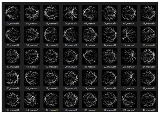 Retinal Vascular Image Segmentation Using Improved UNet Based on Residual Module