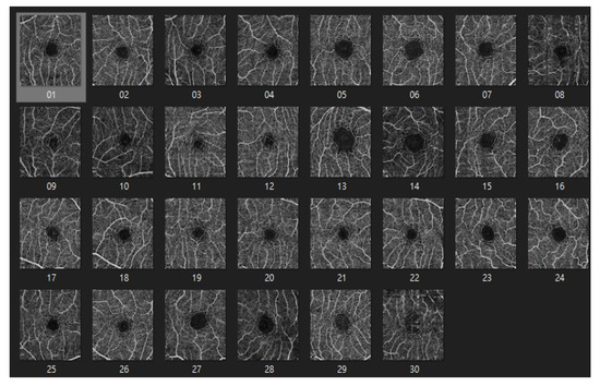 Retinal Vascular Image Segmentation Using Improved UNet Based on Residual Module