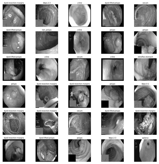 EnsemDeepCADx: Empowering Colorectal Cancer Diagnosis with Mixed ...