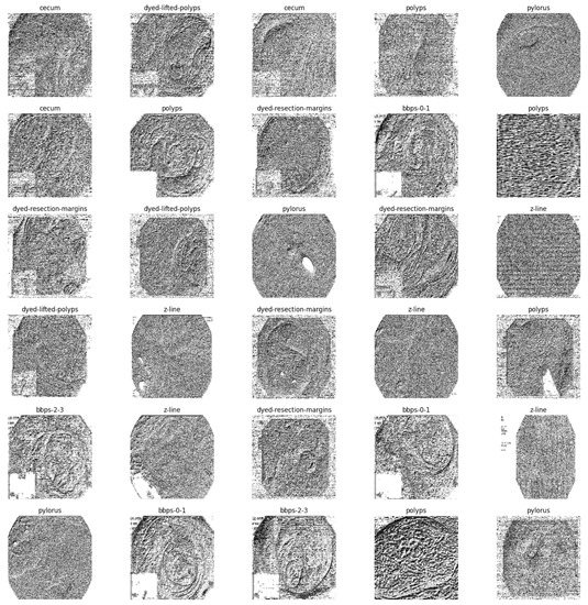 Bioengineering | Free Full-Text | EnsemDeepCADx: Empowering Colorectal ...