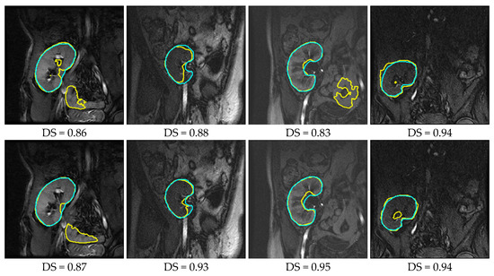 Kidney Segmentation from Dynamic Contrast-Enhanced Magnetic Resonance ...