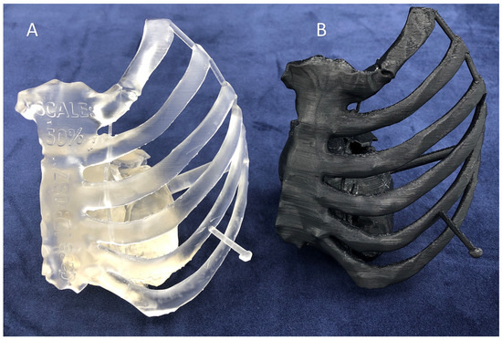 Medical 3D Printing Using Desktop Inverted Vat Photopolymerization ...