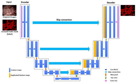 Semantic Segmentation of Gastric Polyps in Endoscopic Images Based on Convolutional Neural ...