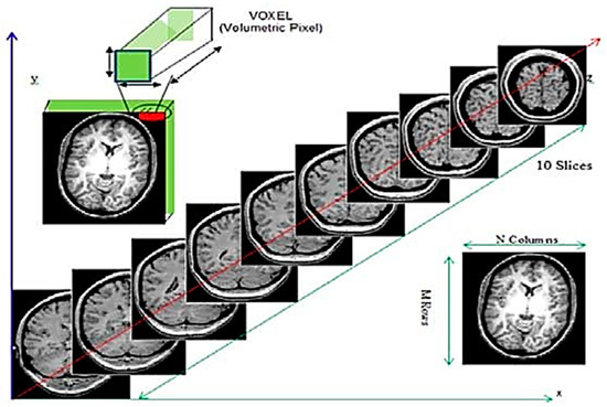 A New Medical Analytical Framework for Automated Detection of MRI Brain ...