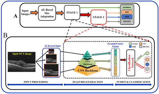 Multi-Stage Classification of Retinal OCT Using Multi-Scale Ensemble Deep Architecture