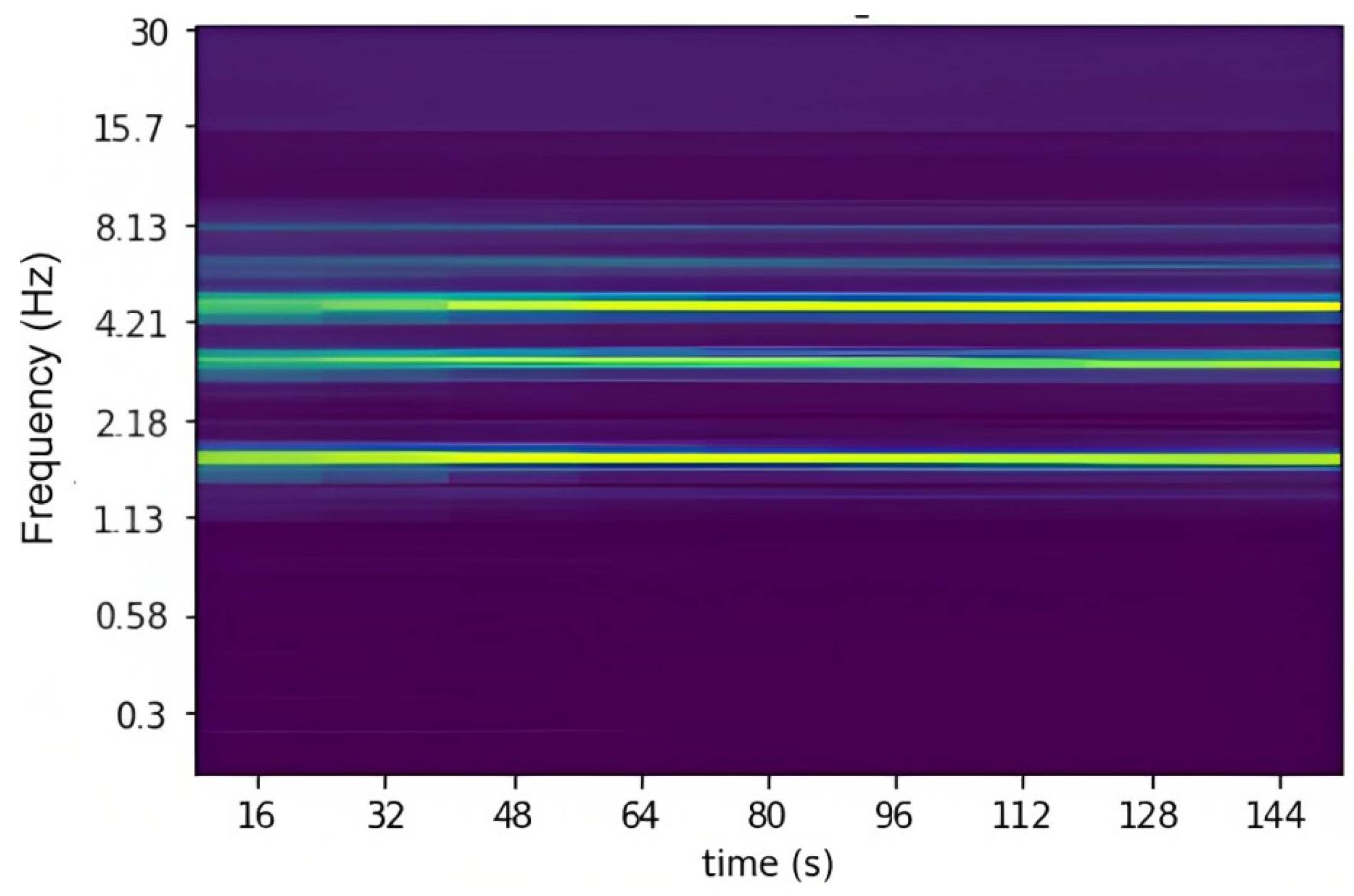 Bioengineering | Free Full-Text | Robust Heart Rate Variability ... Bioengineering | Free Full-Text | Robust Heart Rate Variability ...