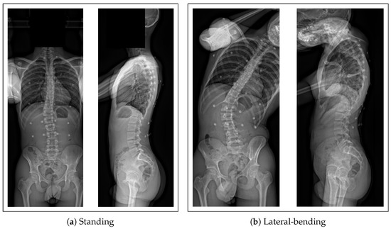 Multi-Modal Data Correspondence for the 4D Analysis of the Spine with ...