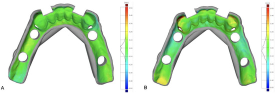 Effect of Fabrication Technology on the Accuracy of Surgical Guides for ...