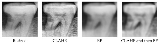 Deep Learning-Based Recognition of Periodontitis and Dental Caries in ...