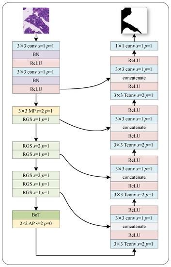 RGSB-UNet: Hybrid Deep Learning Framework for Tumour Segmentation in Digital Pathology Images