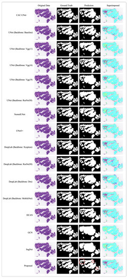 RGSB-UNet: Hybrid Deep Learning Framework for Tumour Segmentation in Digital Pathology Images