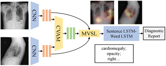 Bioengineering | Free Full-Text | Automatic Medical Report Generation ...