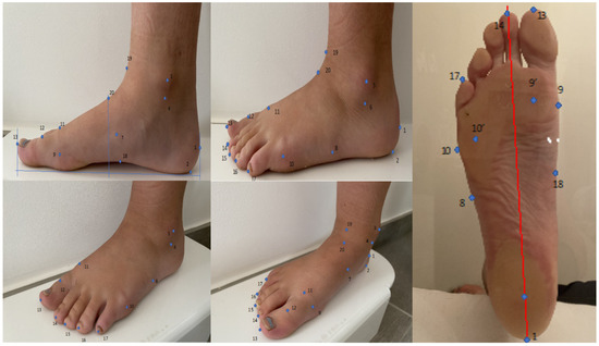 Validation of an Automated Optical Scanner for a Comprehensive ...