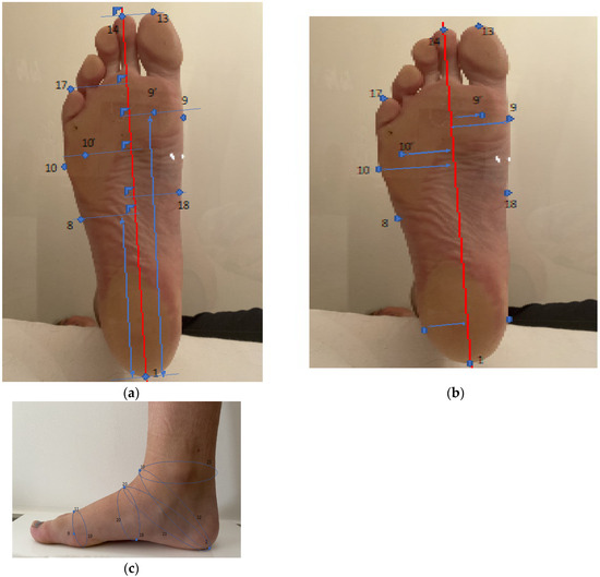 Validation of an Automated Optical Scanner for a Comprehensive ...