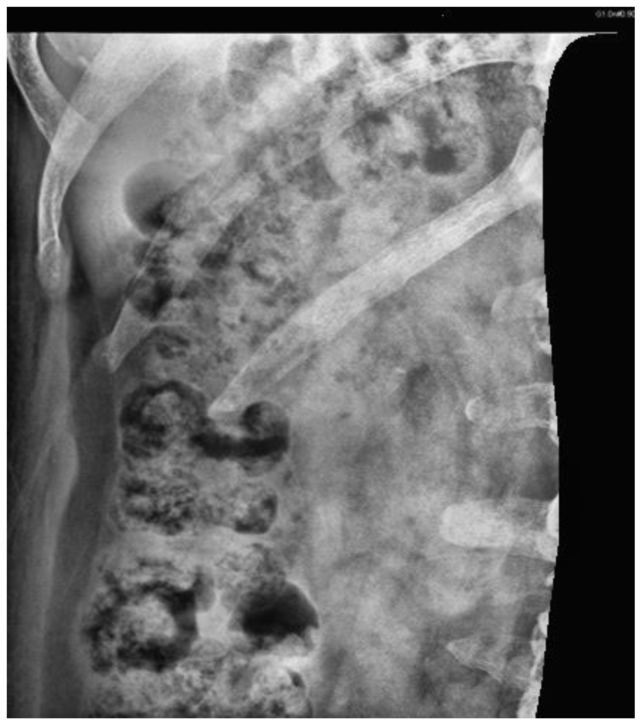 Design and Validation of a Deep Learning Model for Renal Stone Detection and Segmentation on ...