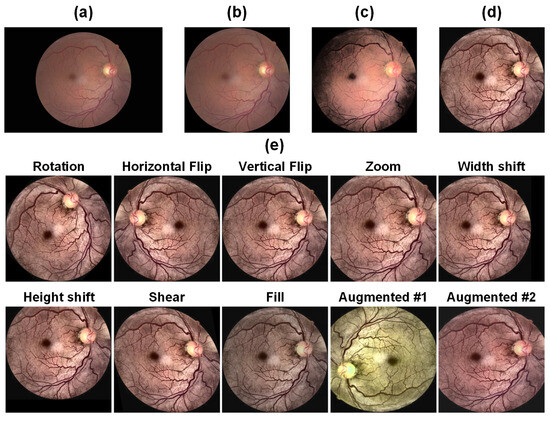 Bioengineering | Free Full-Text | MIL-CT: Multiple Instance Learning via a Cross-Scale ...