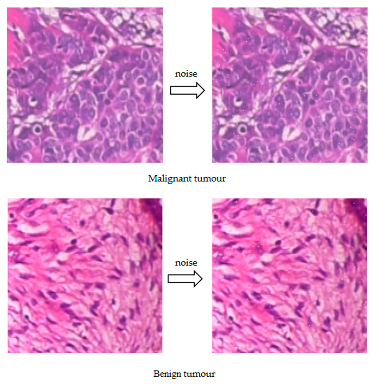 Bioengineering | Free Full-Text | Adversarial Attack and Defense in ... Bioengineering | Free Full-Text | Adversarial Attack and Defense in ...