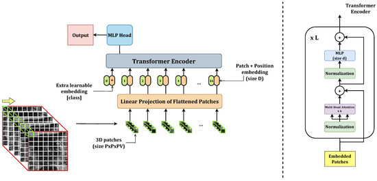 3D-Vision-Transformer Stacking Ensemble for Assessing Prostate Cancer ...