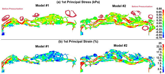 Bioengineering | Free Full-Text | Biomechanics of the JCT and SC Inner ...