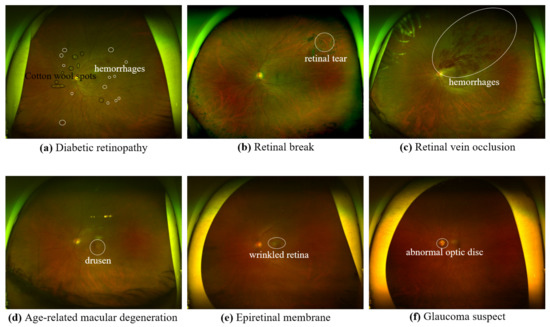 Discriminative-Region Multi-Label Classification of Ultra-Widefield ...