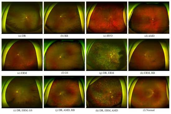 Discriminative-Region Multi-Label Classification of Ultra-Widefield ...