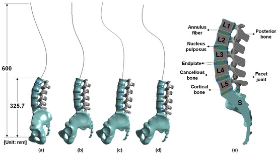 Biomechanical Effects of Different Sitting Postures and Physiologic ...