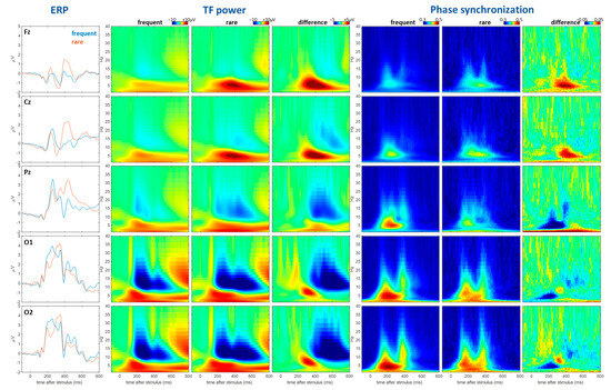Bioengineering | Free Full-Text | Exploiting Information in Event-Related Brain Potentials from ...