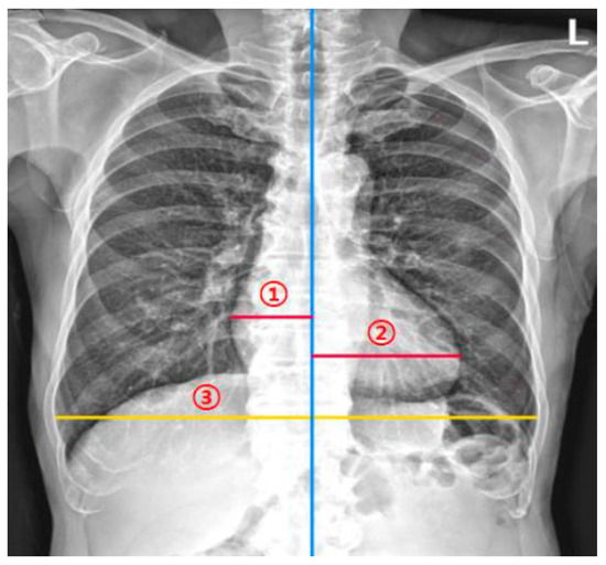 The Performance of a Deep Learning-Based Automatic Measurement Model for Measuring the ...