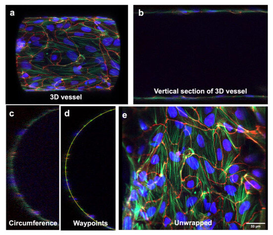 Bioengineering | Free Full-Text | A Rapid-Patterning 3D Vessel-on-Chip ...
