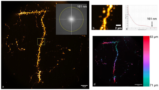 Super-Resolution Imaging of Neuronal Structures with Structured ...
