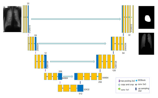 MWG-UNet: Hybrid Deep Learning Framework for Lung Fields and Heart ...