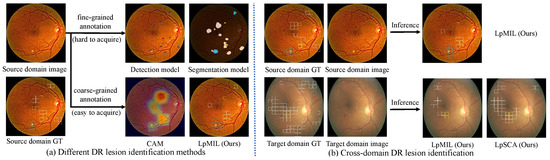 Bioengineering | Free Full-Text | A Cross-Domain Weakly Supervised Diabetic Retinopathy Lesion ...