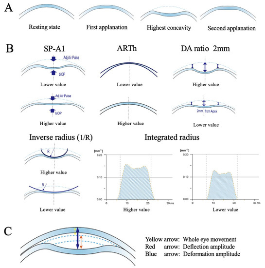 Corneal Biomechanical Measures for Glaucoma: A Clinical Approach