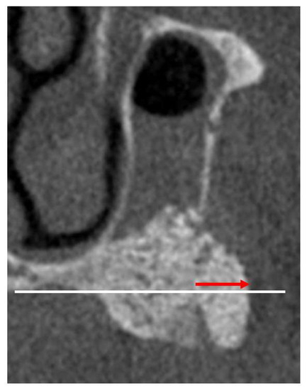 The Effectiveness and Practicality of a Novel Barrier Membrane for the ...