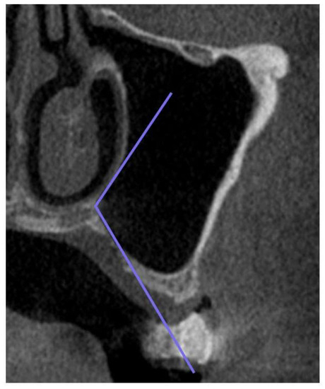 The Effectiveness and Practicality of a Novel Barrier Membrane for the ...