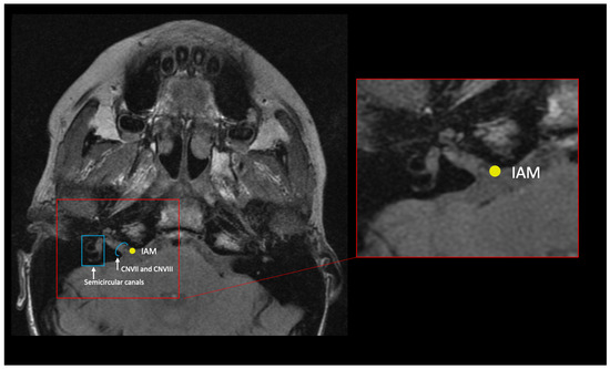 Bioengineering | Free Full-Text | Using Geometric Morphometric Analysis ...