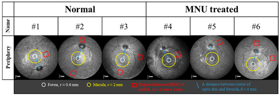 The Variation of Electrical Pulse Duration Elicits Reliable Network ...