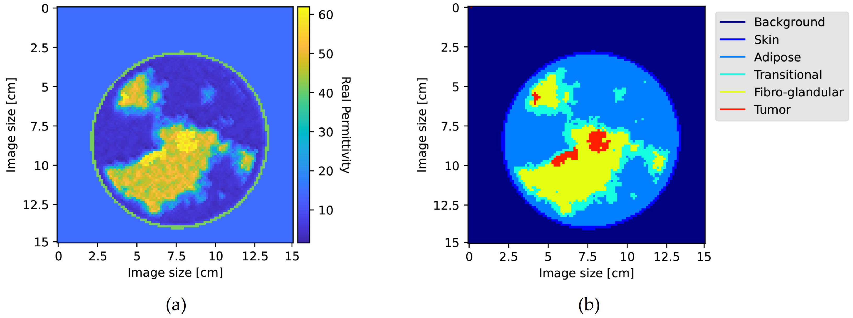 Bioengineering | Free Full-Text | Microwave Breast Sensing via Deep ...