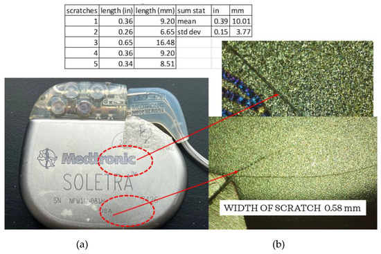 Investigation of a Deep Brain Stimulator (DBS) System