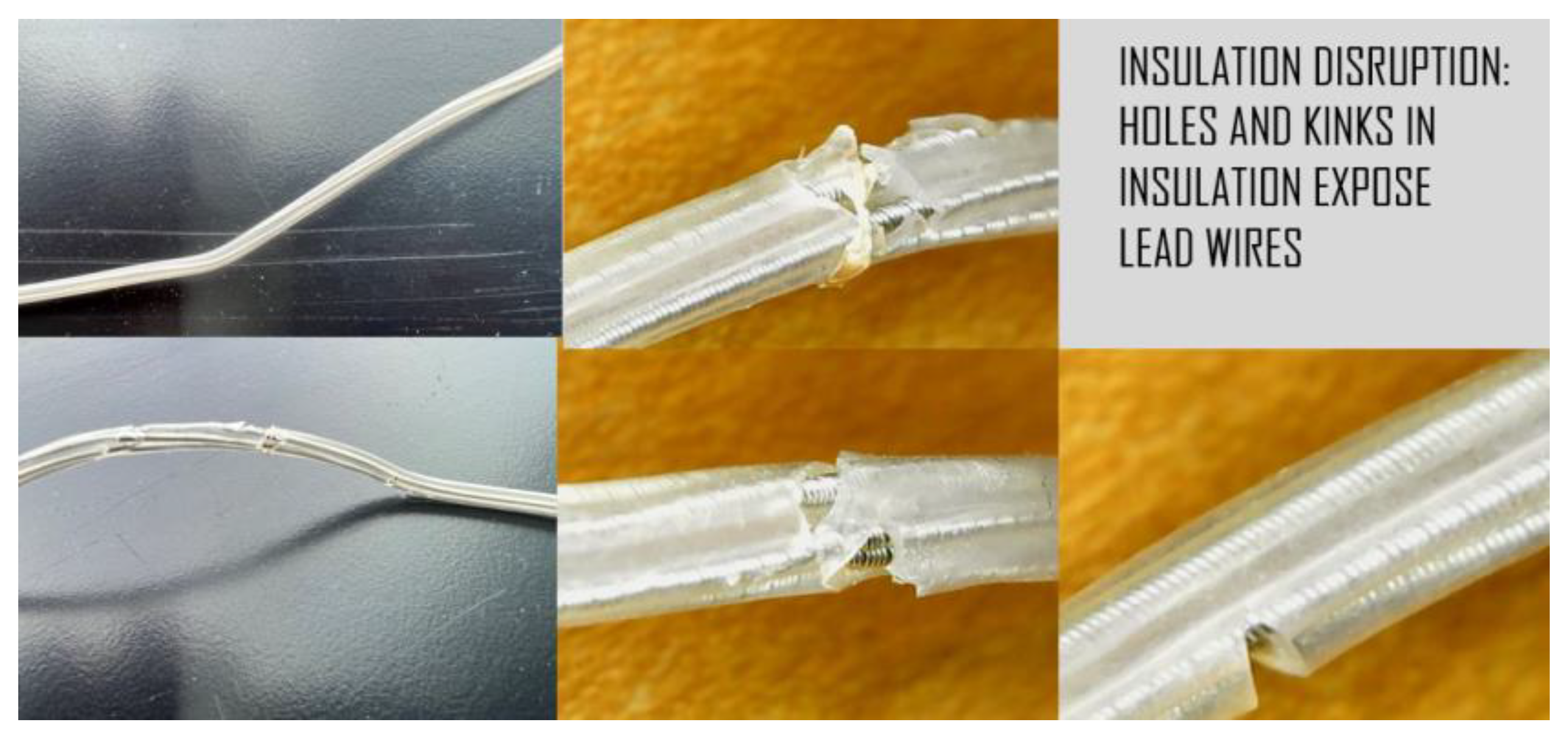 Investigation of a Deep Brain Stimulator (DBS) System