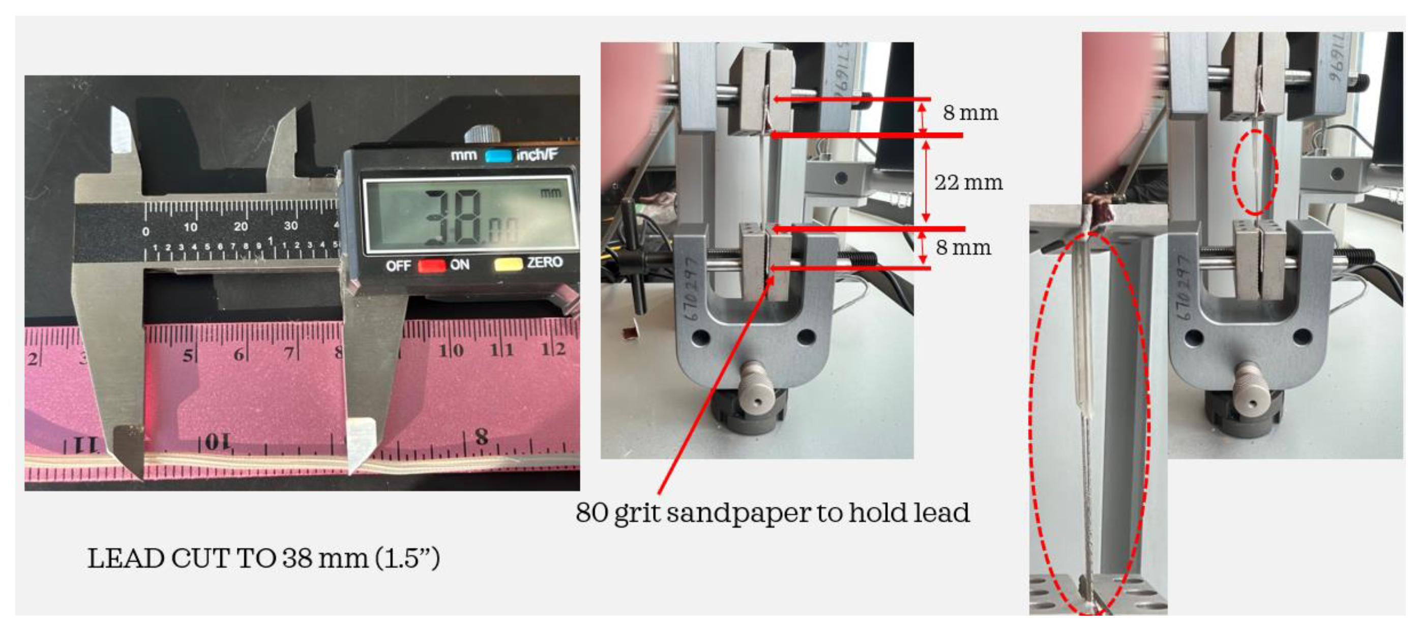 Investigation of a Deep Brain Stimulator (DBS) System
