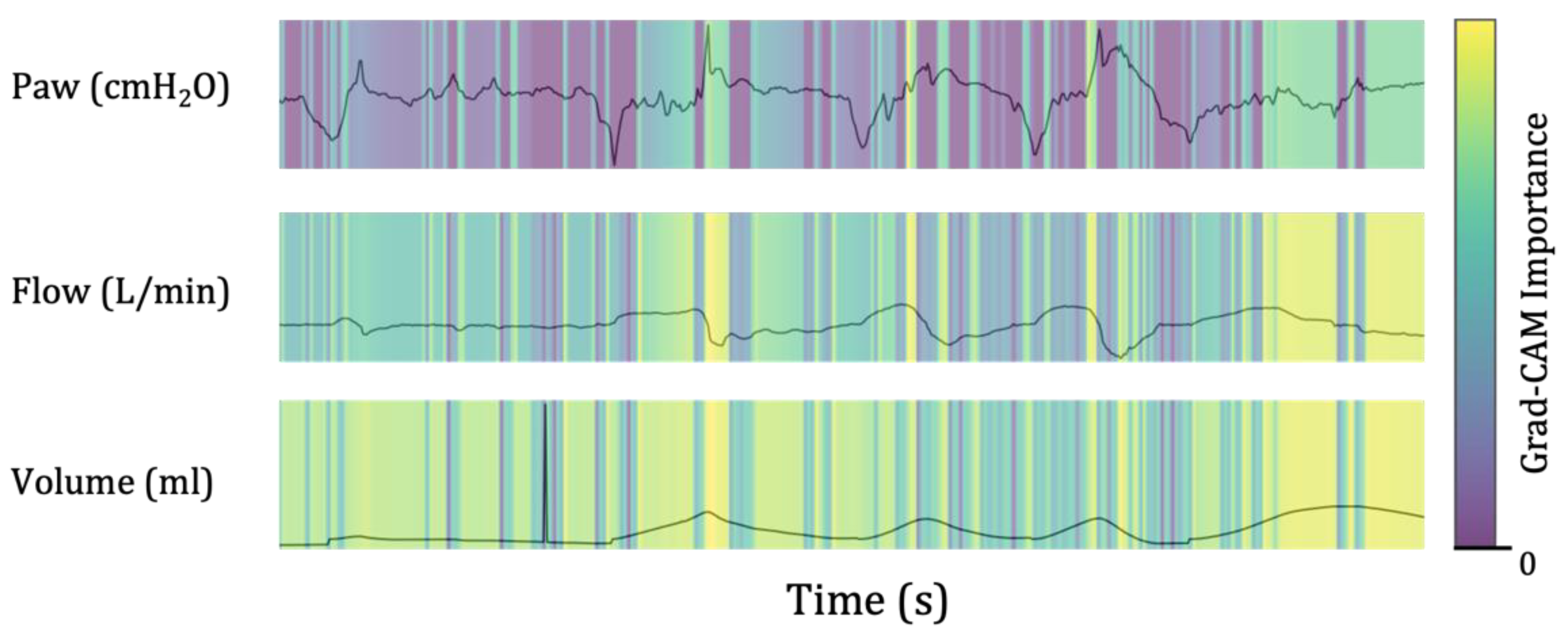 Development of a Machine Learning Model for Predicting Weaning Outcomes ...